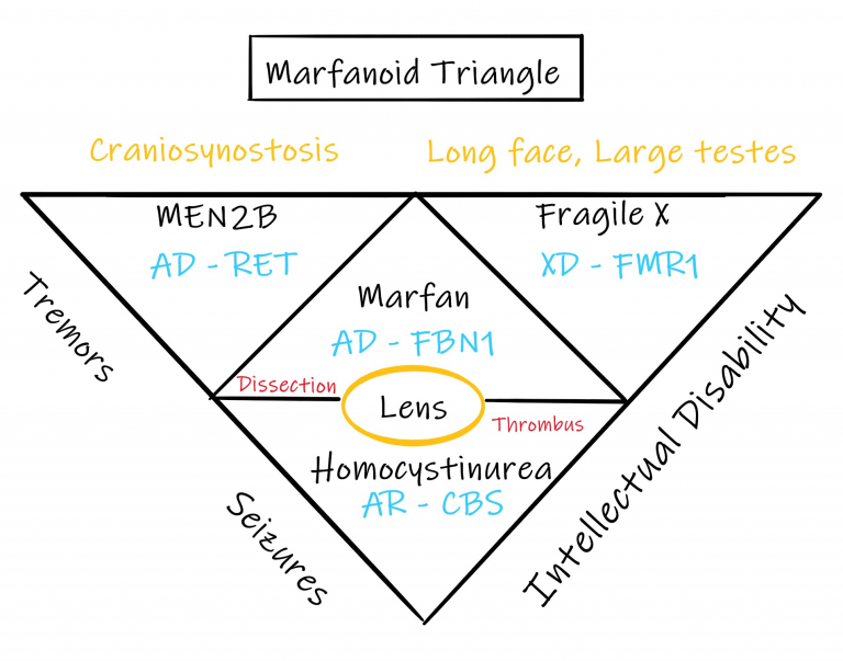 Marfanoid Triangle